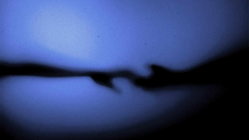 People pleaser: Definition, signs, risks, and how to stop