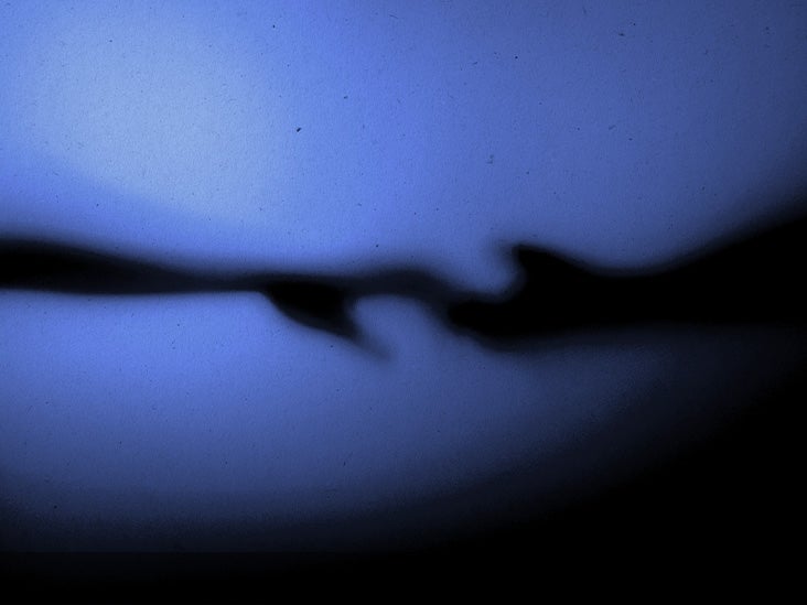 People pleaser: Definition, signs, risks, and how to stop