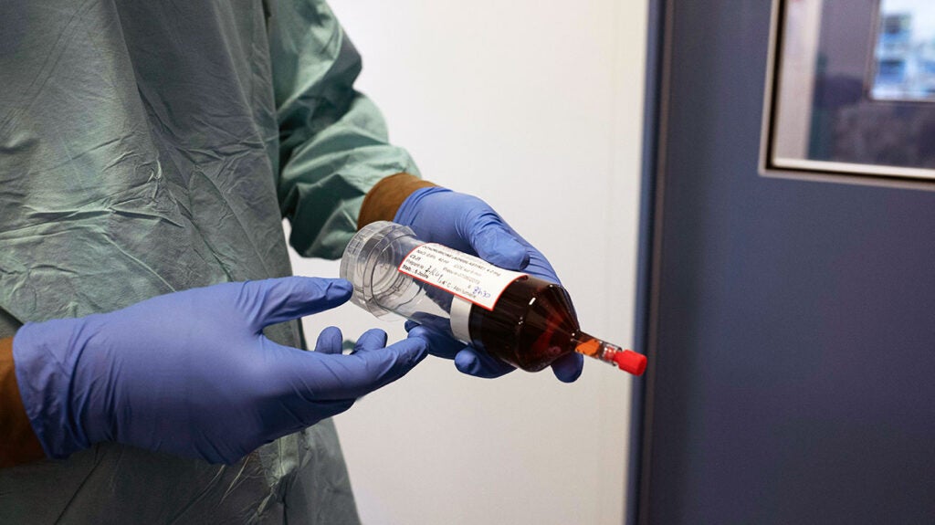 Intraperitoneal chemotherapy: Procedure and side effects