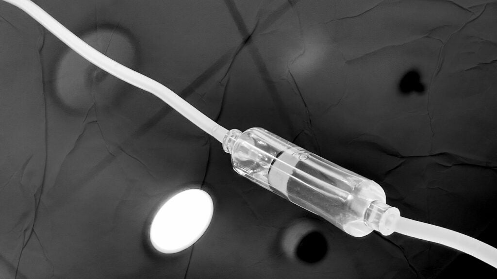 Intravesical chemotherapy: Procedure, side effects, and outlook