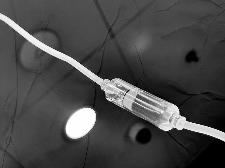 Intravesical chemotherapy: Procedure, side effects, and outlook