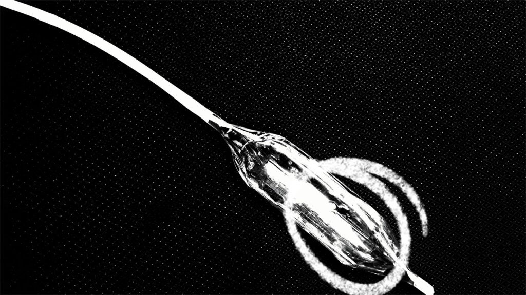 PCI for heart disease: Risks, benefits, results, and more