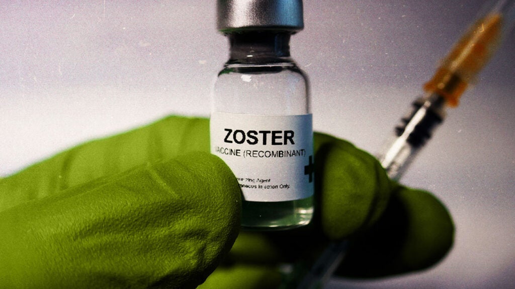 Can you get shingles if you haven't had chickenpox?