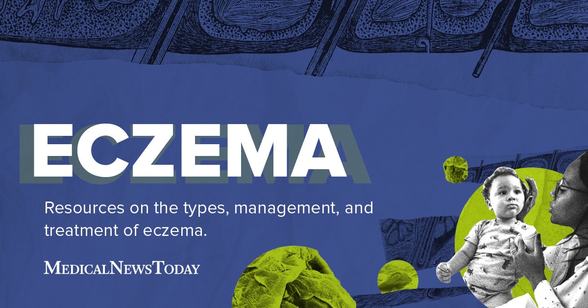 Eczema: Resources on management and treatment.