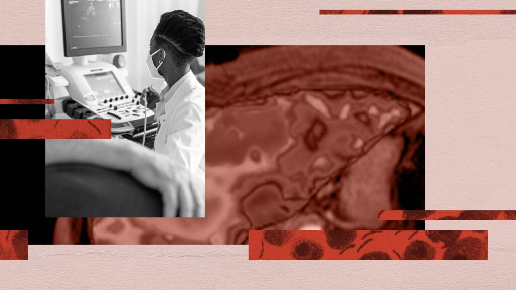 Liver elastography: Overview and what to expect