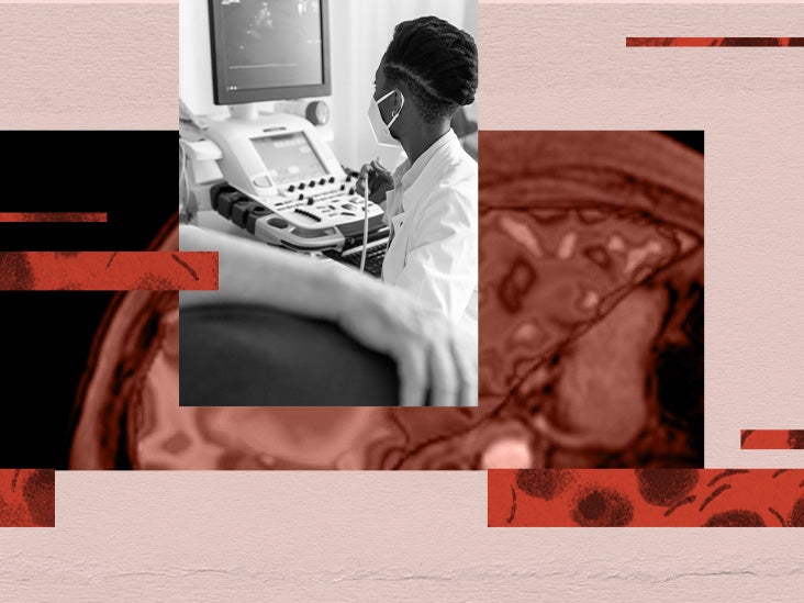 Liver elastography: Overview and what to expect