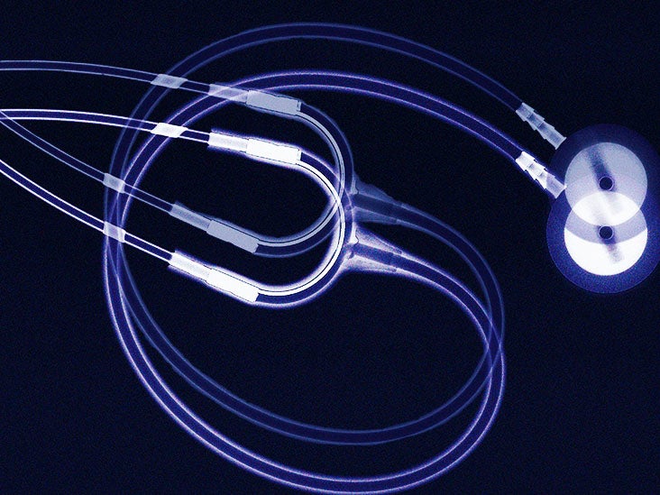 Heart sounds: What they are, and what is expected