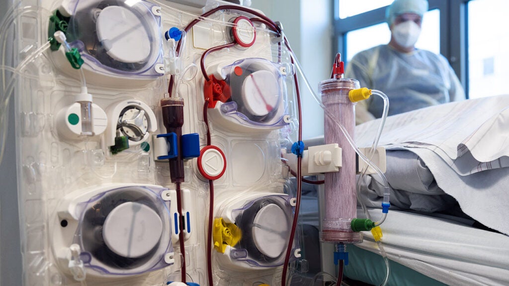 Acute kidney injury: Symptoms, causes, treatment, and more