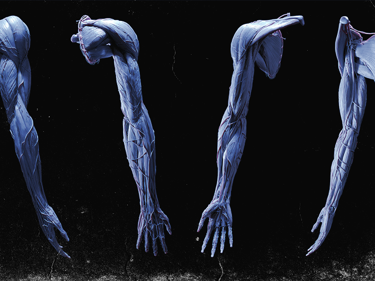 Tendinopathy: Symptoms, causes, and treatment