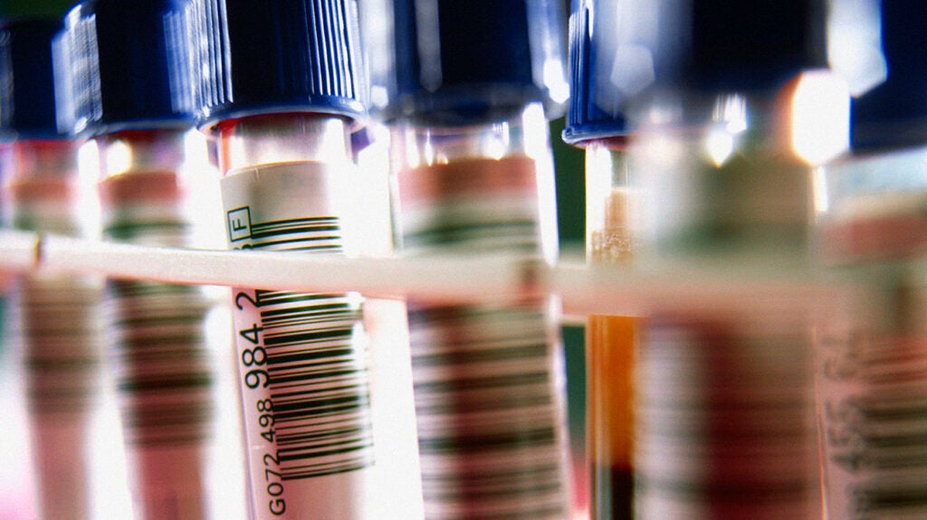 Is cholesterol a steroid?