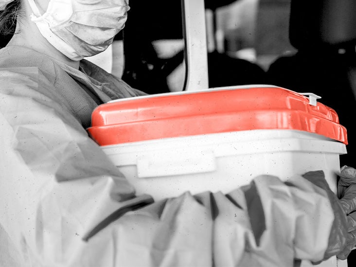 Heart transplant: How it works, cost, insurance, and more