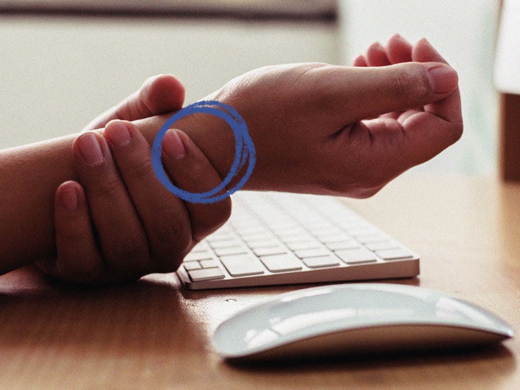 Tenosynovitis: What it is, symptoms, causes, and more