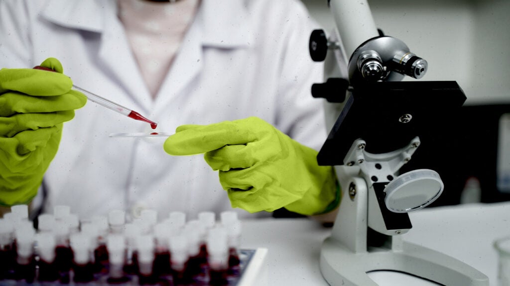 Lipid panel: Procedure and what to expect