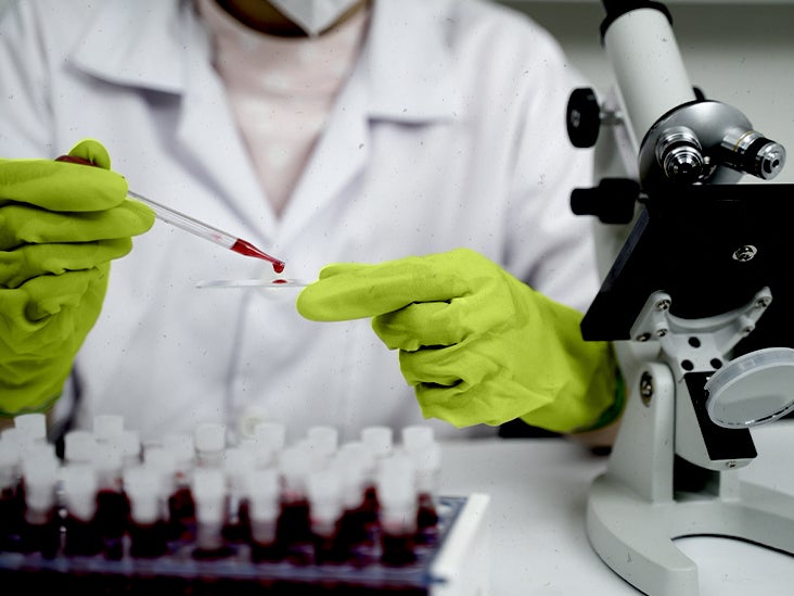 Lipid Panel Procedure And What To Expect