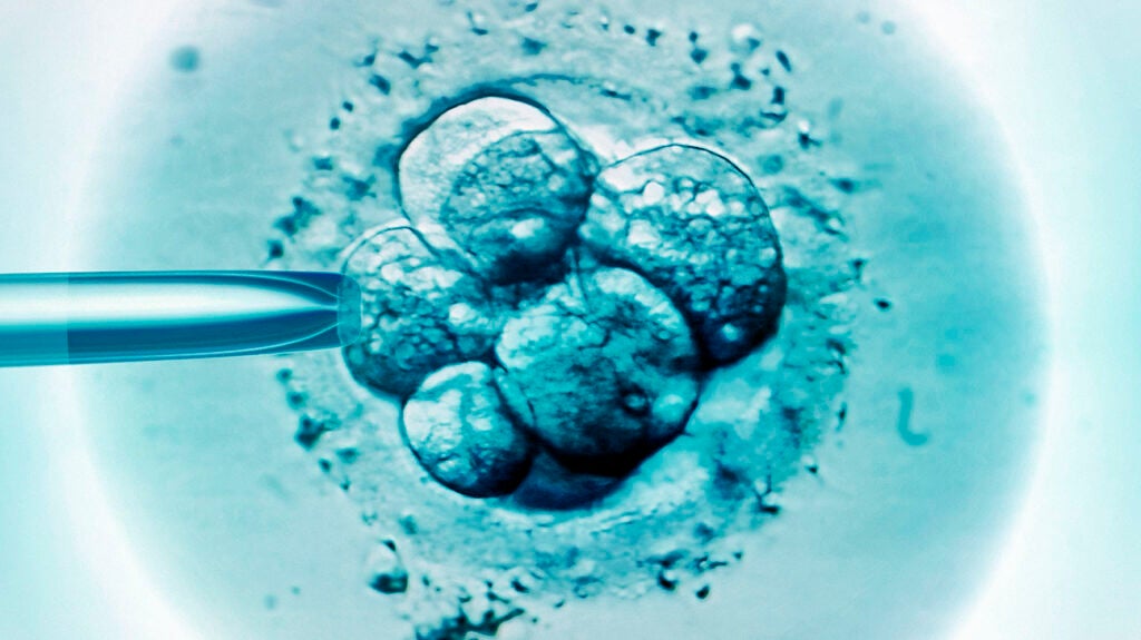 Scientists say they have created 'embryos' without sperm or eggs