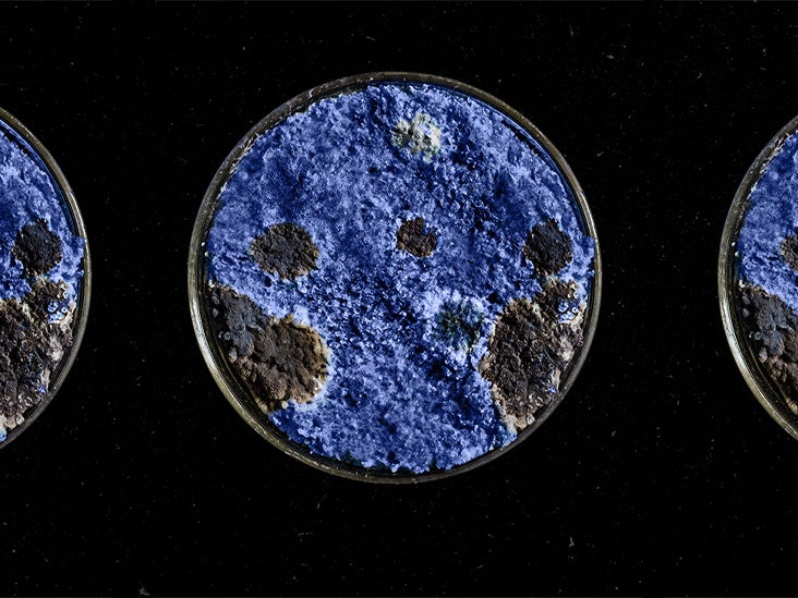 Allergy to mold: Symptoms, causes, treatment, and FAQs