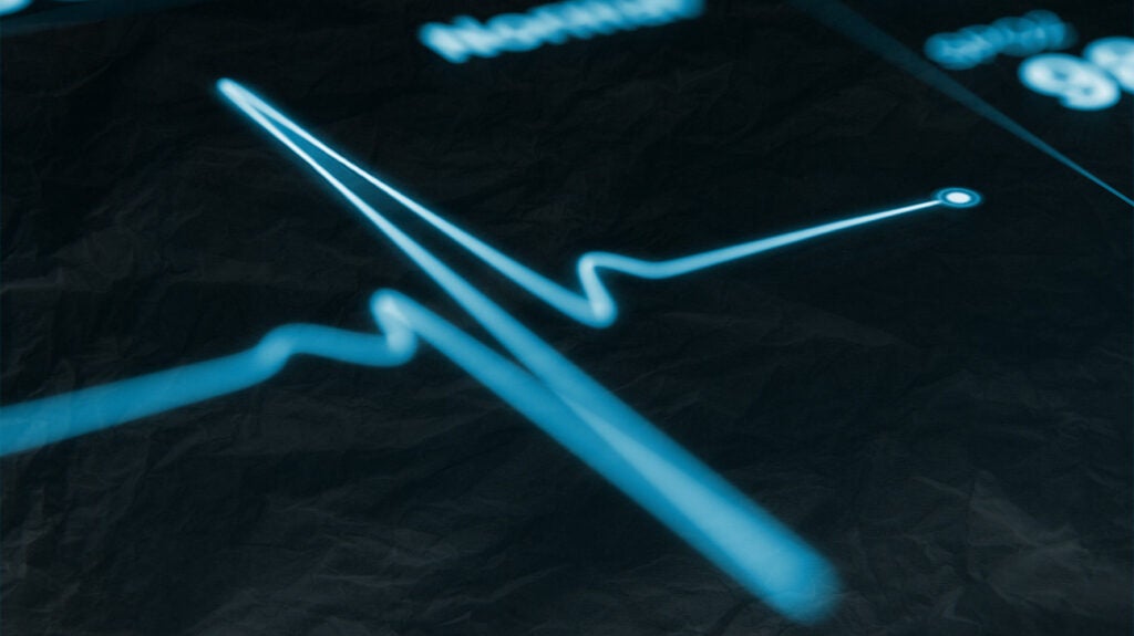 Left bundle branch block: Symptoms, causes, and treatment