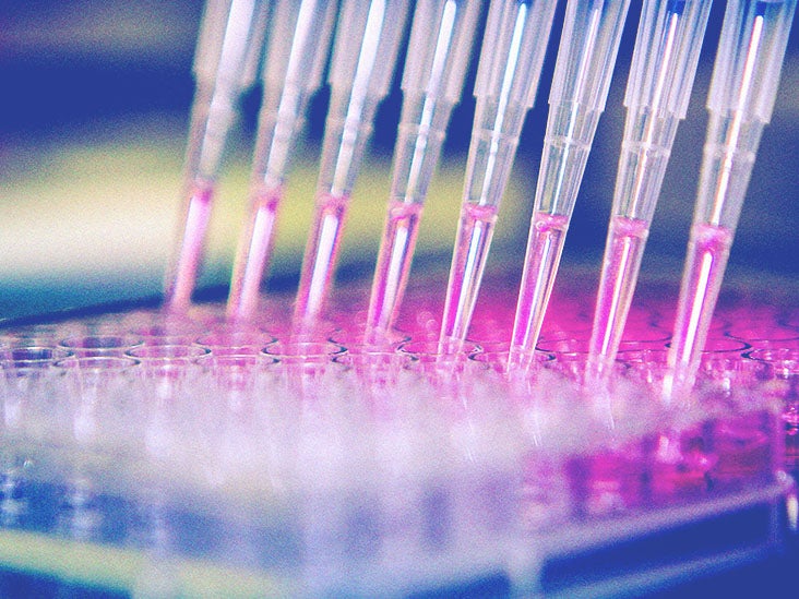 Spinal muscular atrophy (SMA) treatment: Cost, guidelines, support