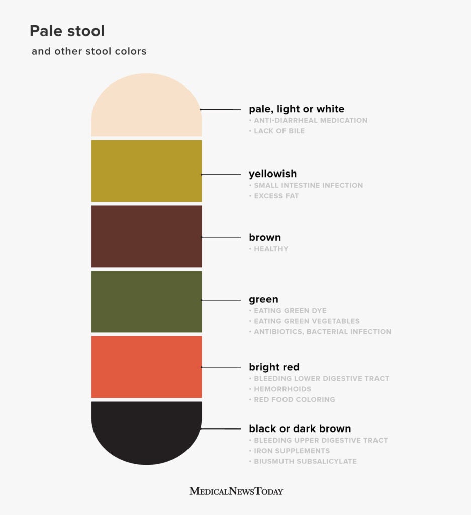 Pale Stool Causes Diagnosis And Treatment