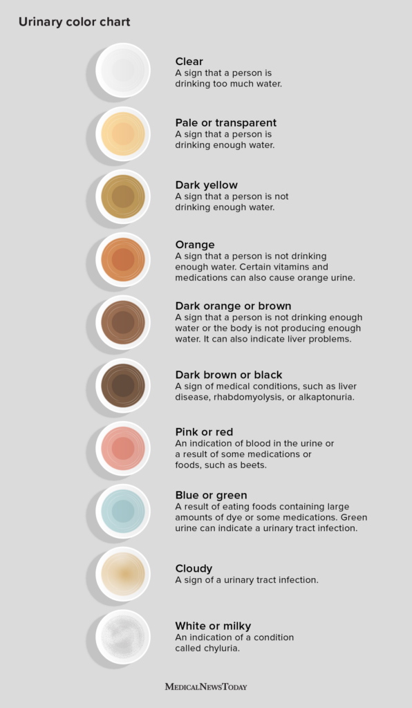 Urine Color Chart Healthy Colors And When To Seek Help Urine Color Chart Healthy Colors And When To Seek Help