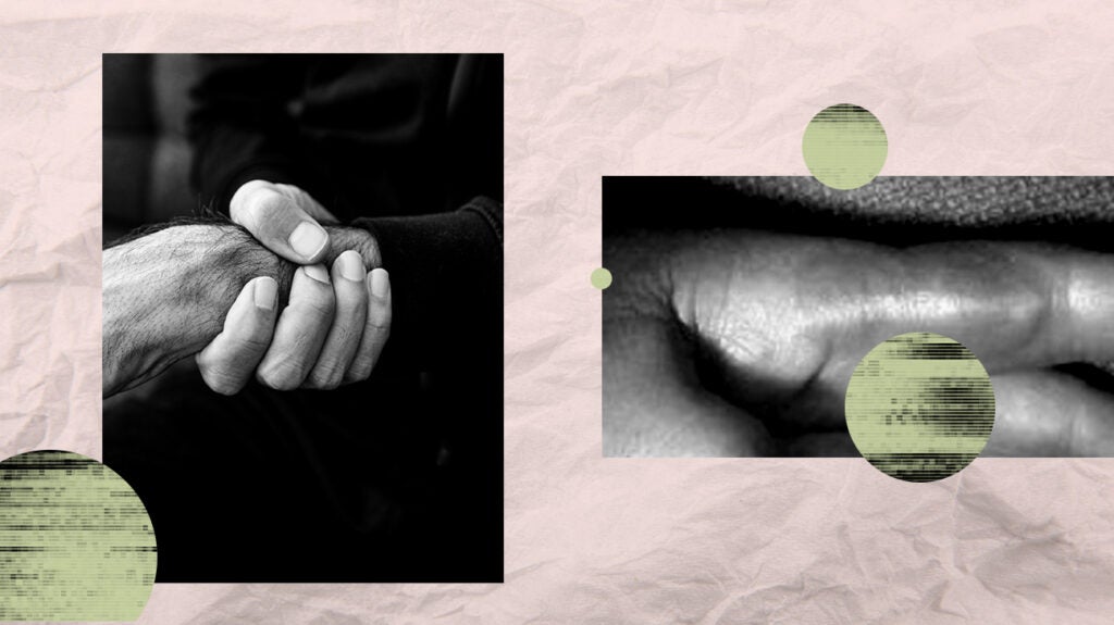 Sweet syndrome: Causes, symptoms, and treatment