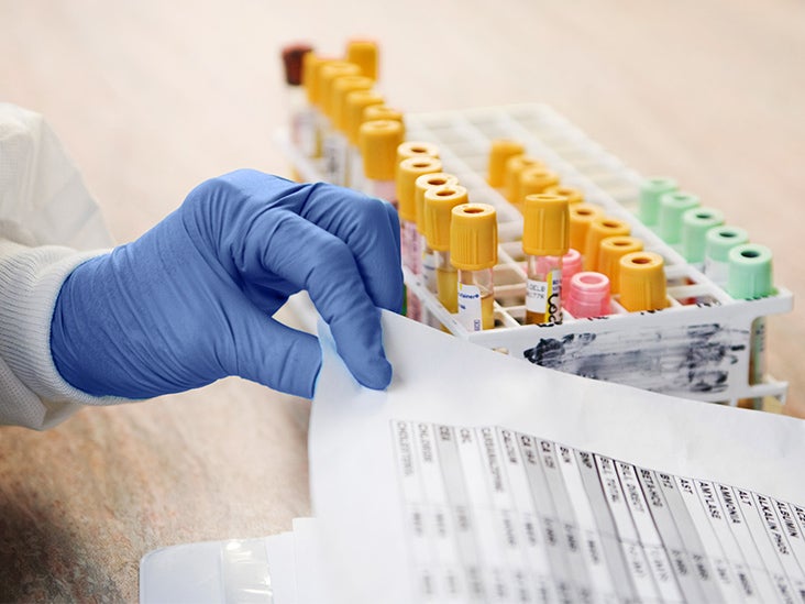 Lactate dehydrogenase (LDH) test: Uses and results