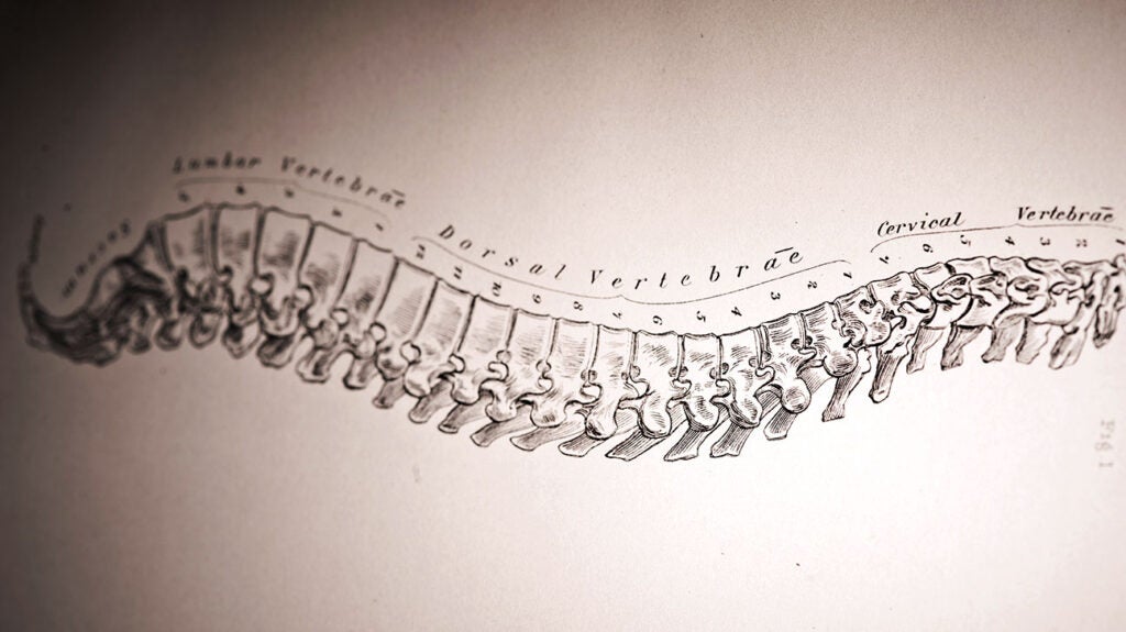 Cervical stenosis in the spine: Symptoms and treatment
