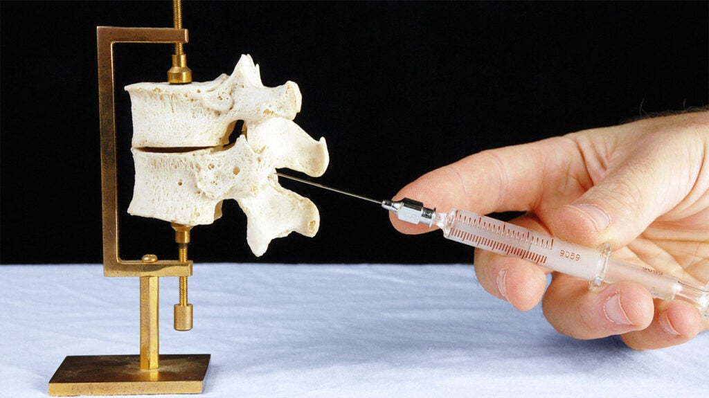 Injection Sites Injection Sites
