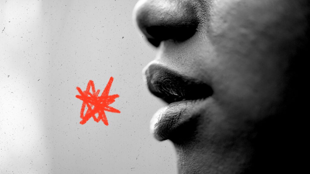 Expressive aphasia: Symptoms, causes, and treatment