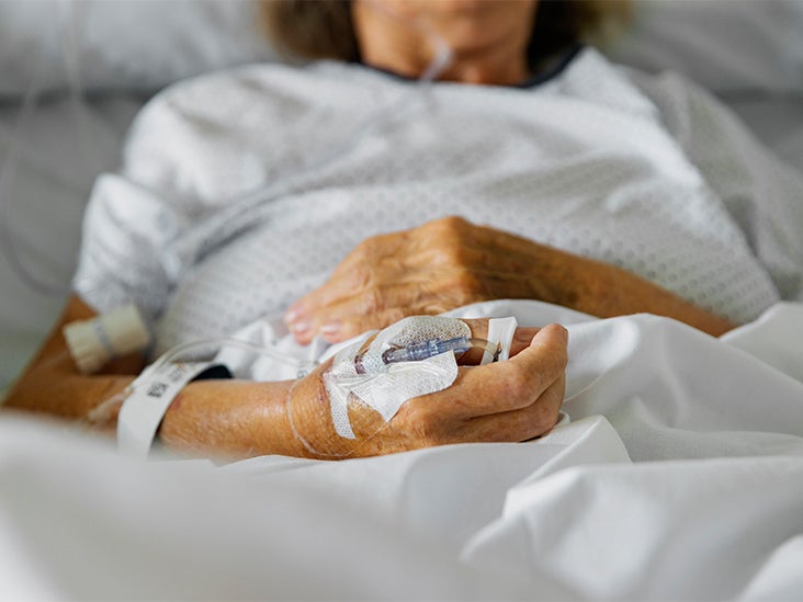 Medullary stroke: Symptoms, treatment, and outlook