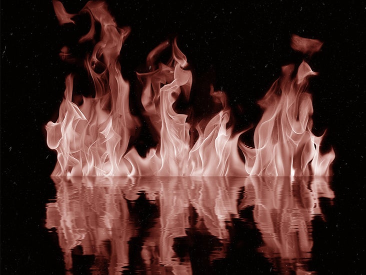 Heartburn that will not go away: Causes and treatment options