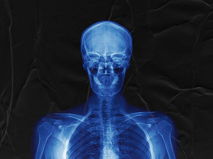 How to heal your bones: Nutritionist - Republic Aeon