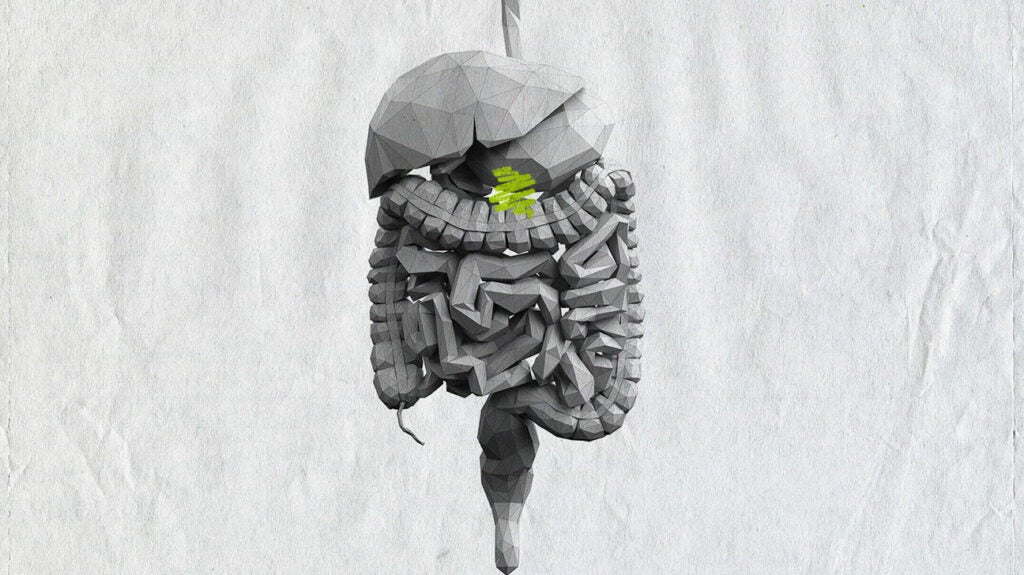 Melanosis coli: Symptoms, causes, treatment, and more