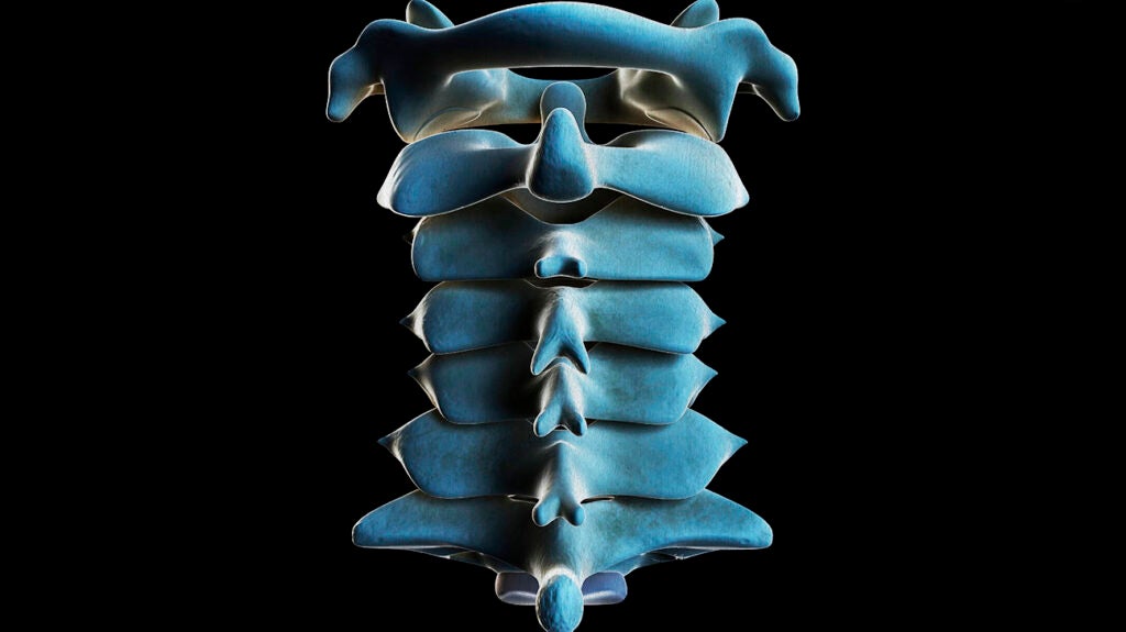 Cervical spinal stenosis: Symptoms, treatment, and exercises