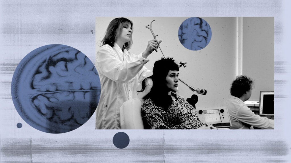 Everything to know about transcranial magnetic stimulation (TMS)