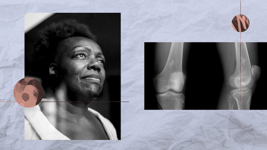 Ewing sarcoma survival rate: Age groups and more