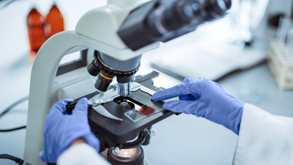 Macrocytic anemia: Causes, symptoms, treatment, and types