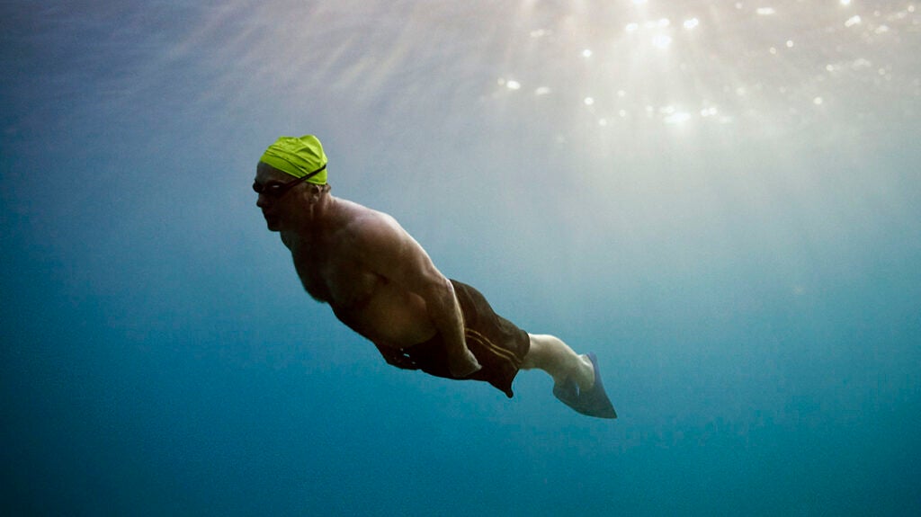 Bone-on-bone arthritis: What it is, symptoms, and treatment