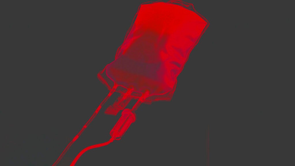 Megaloblastic anemia: Causes, symptoms, and treatment