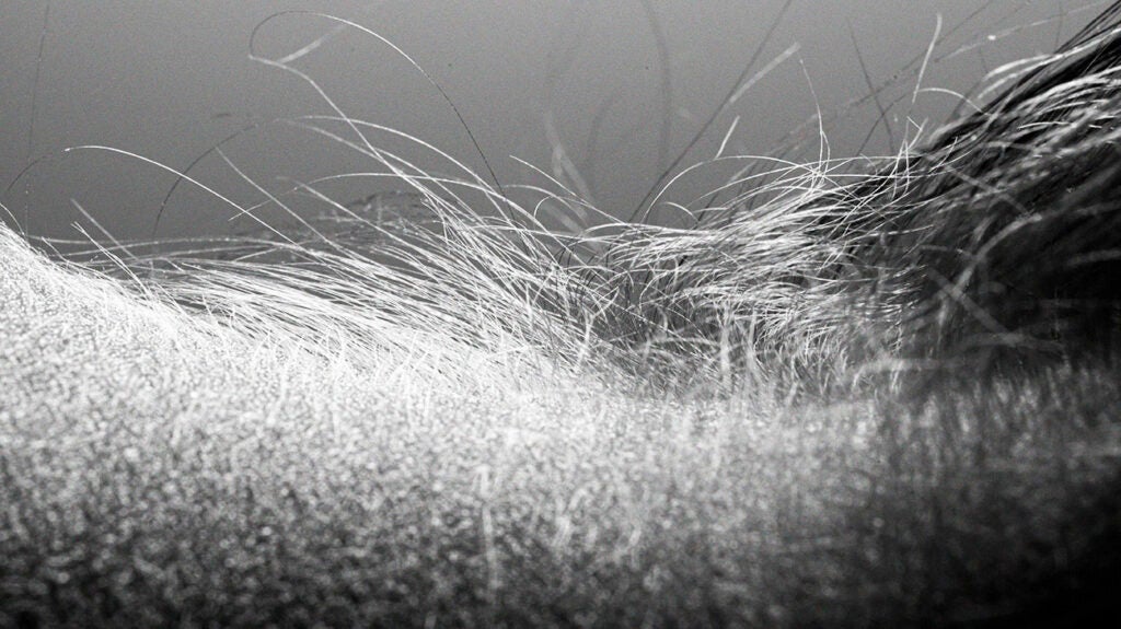 Neck arthritis: Symptoms, types, treatment, and more