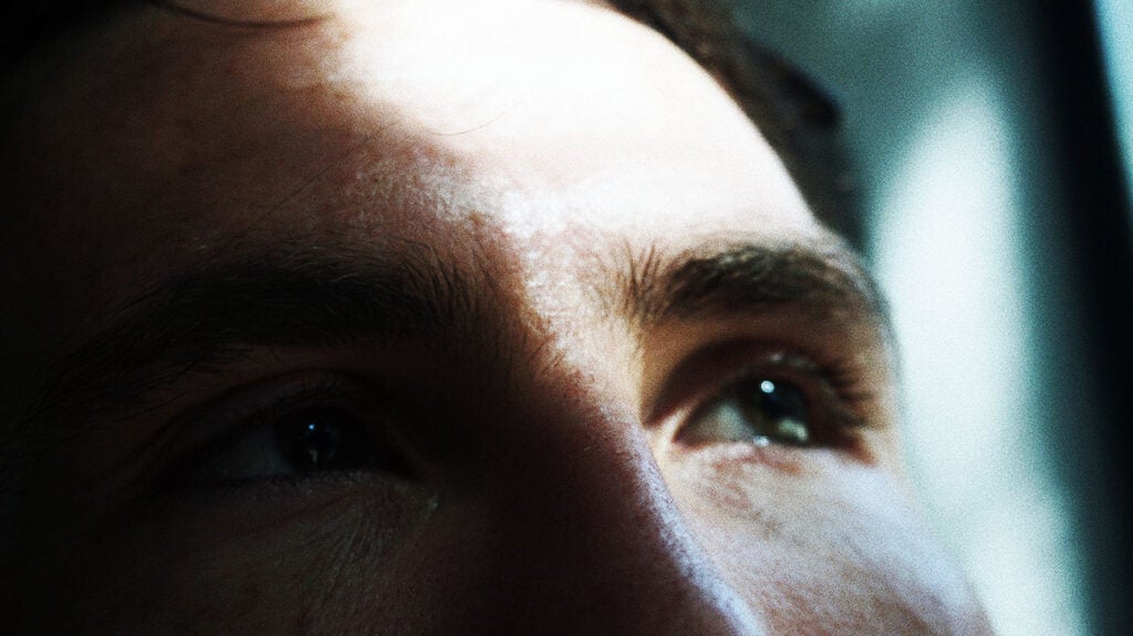 Optic neuritis in MS: Symptoms, causes, and treatment