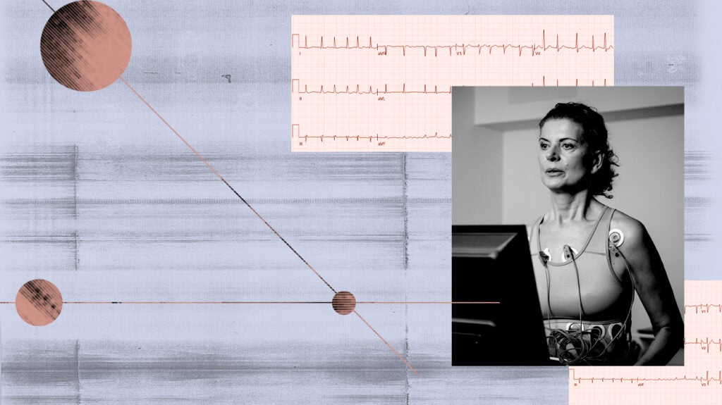 Is atrial fibrillation genetic?