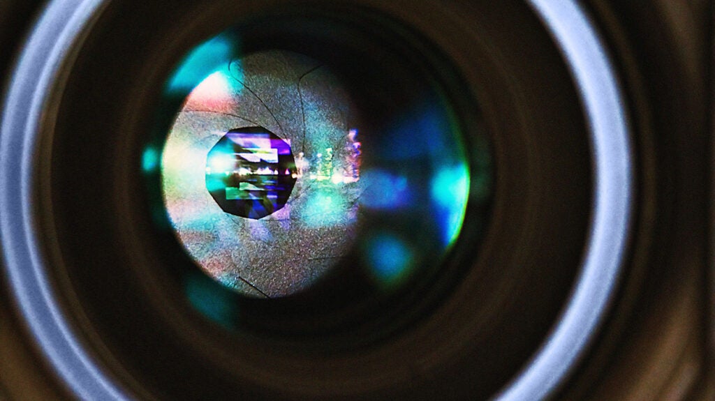 Balint syndrome: Causes, symptoms, and treatment