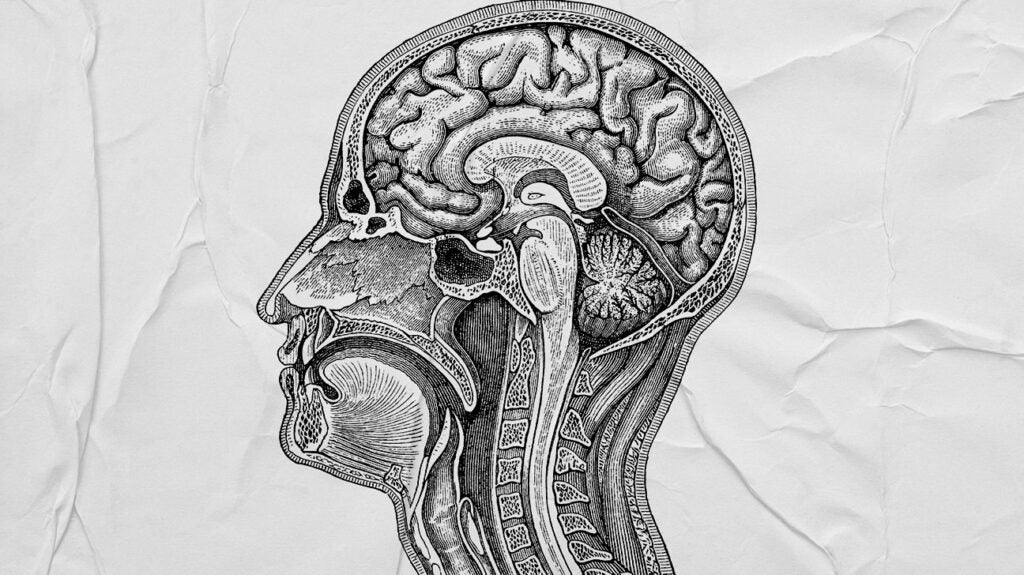Hashimoto encephalopathy: Symptoms, causes, and more