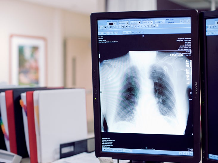 Multiple organ dysfunction syndrome: Symptoms and causes