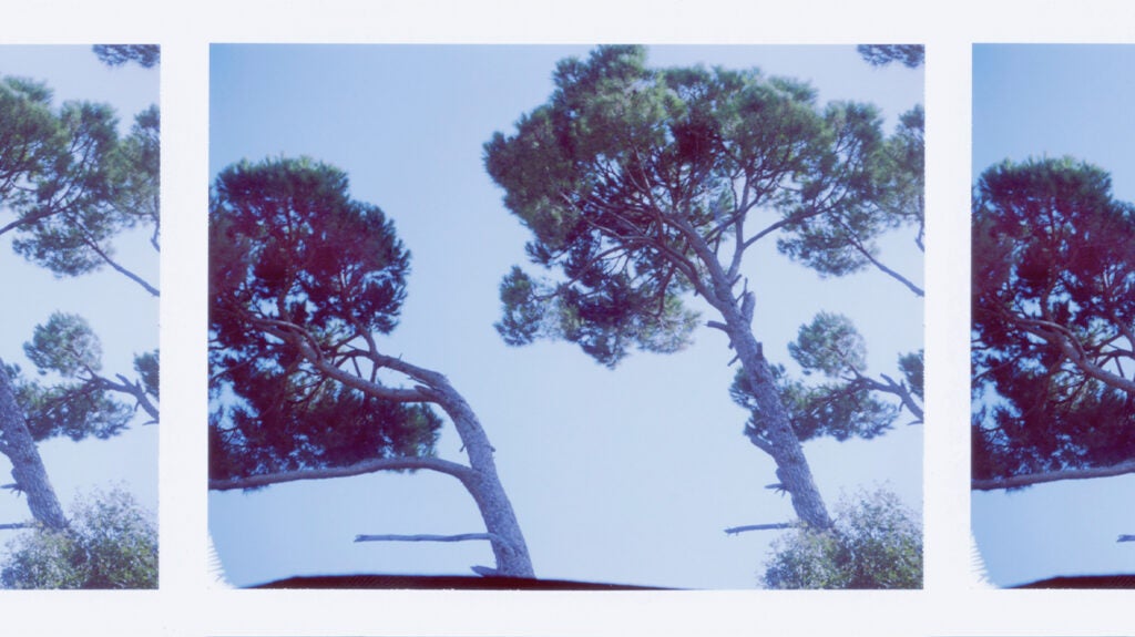 What to know about the symptoms of cedar fever