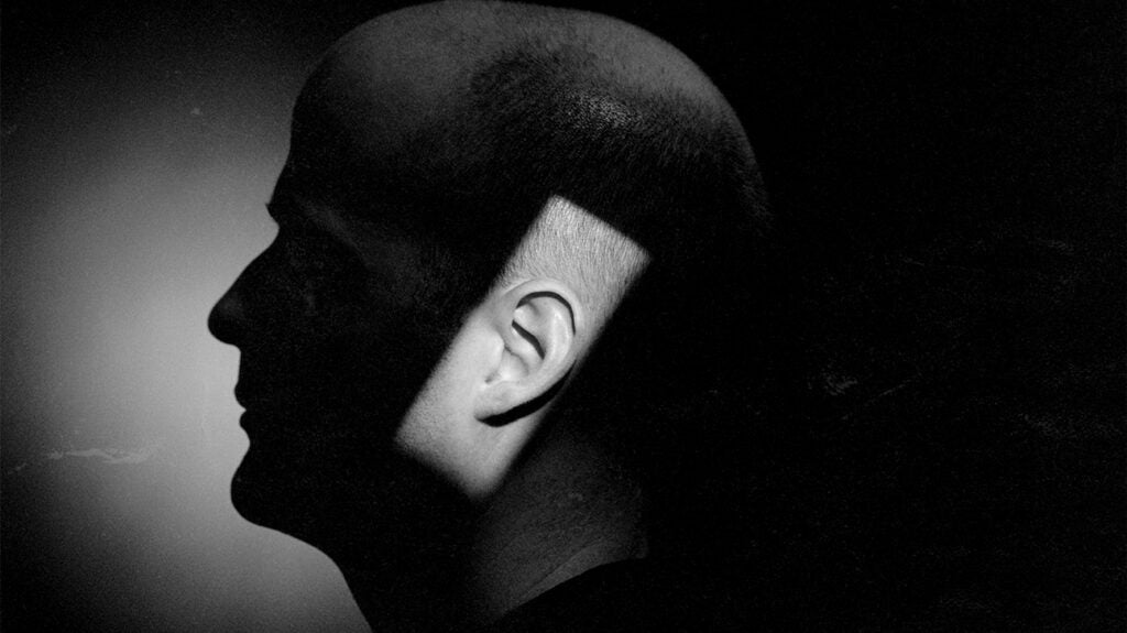 Stapedectomy surgery: Procedure, risks, and more