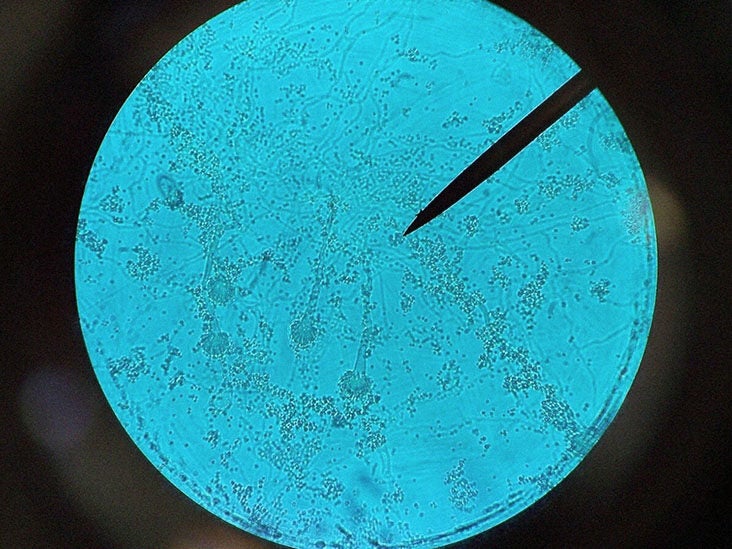 Tooth And Gum Scraping Negative Stain