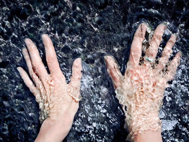 Stroke symptoms in females: What they are and next steps