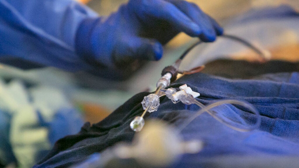 Watchman procedure risks: Statistics and more